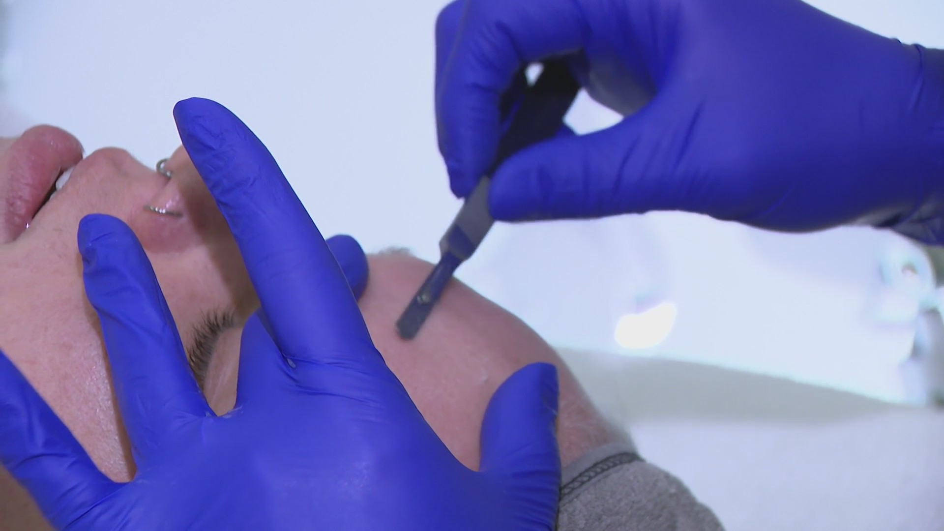 Weekend Break: Winter treatments with SpaDerma in Lincoln Park