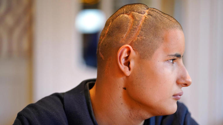 Roque, el superdotado de 18 años que puede usar el 20 % de su cerebro ...