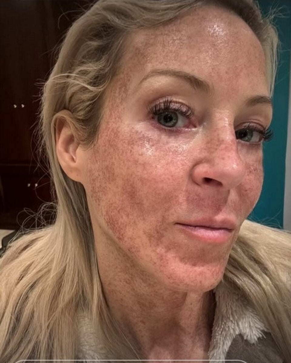 Simone Lugner schockt Fans mit neuem Instagram-Foto