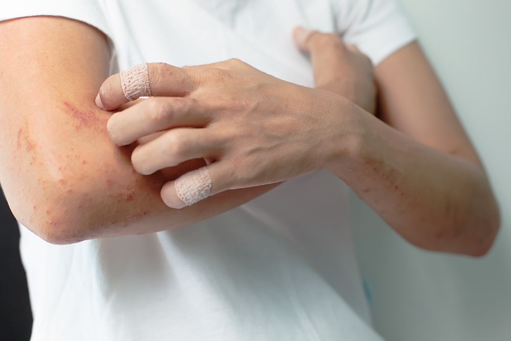 Why your skin dries out – and what you can do about it