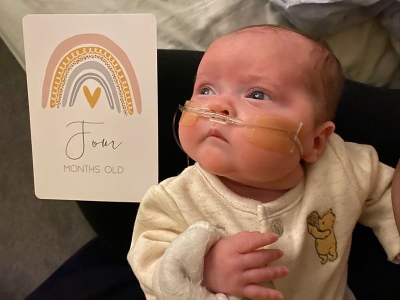 Baby born so early her eyes were sealed shut defies odds to survive