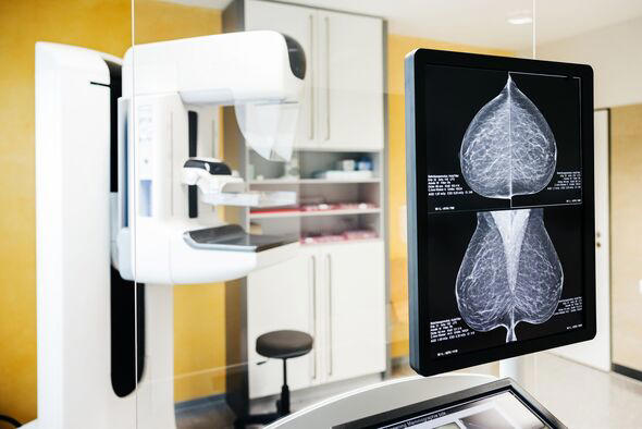 'Lower NHS mammogram age from 50 to 40' update as government issues ...