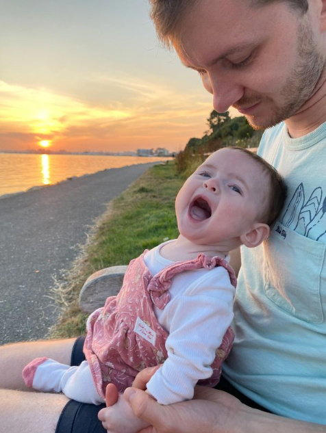 Baby born so early her eyes were sealed shut defies odds to survive