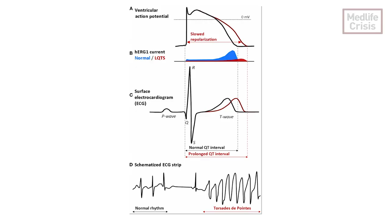 The heart disorder so rare that fear itself can trigger death