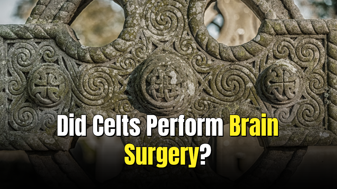Ancient Brain Surgery Tool Found in Poland Suggests Celtic Druids Were ...