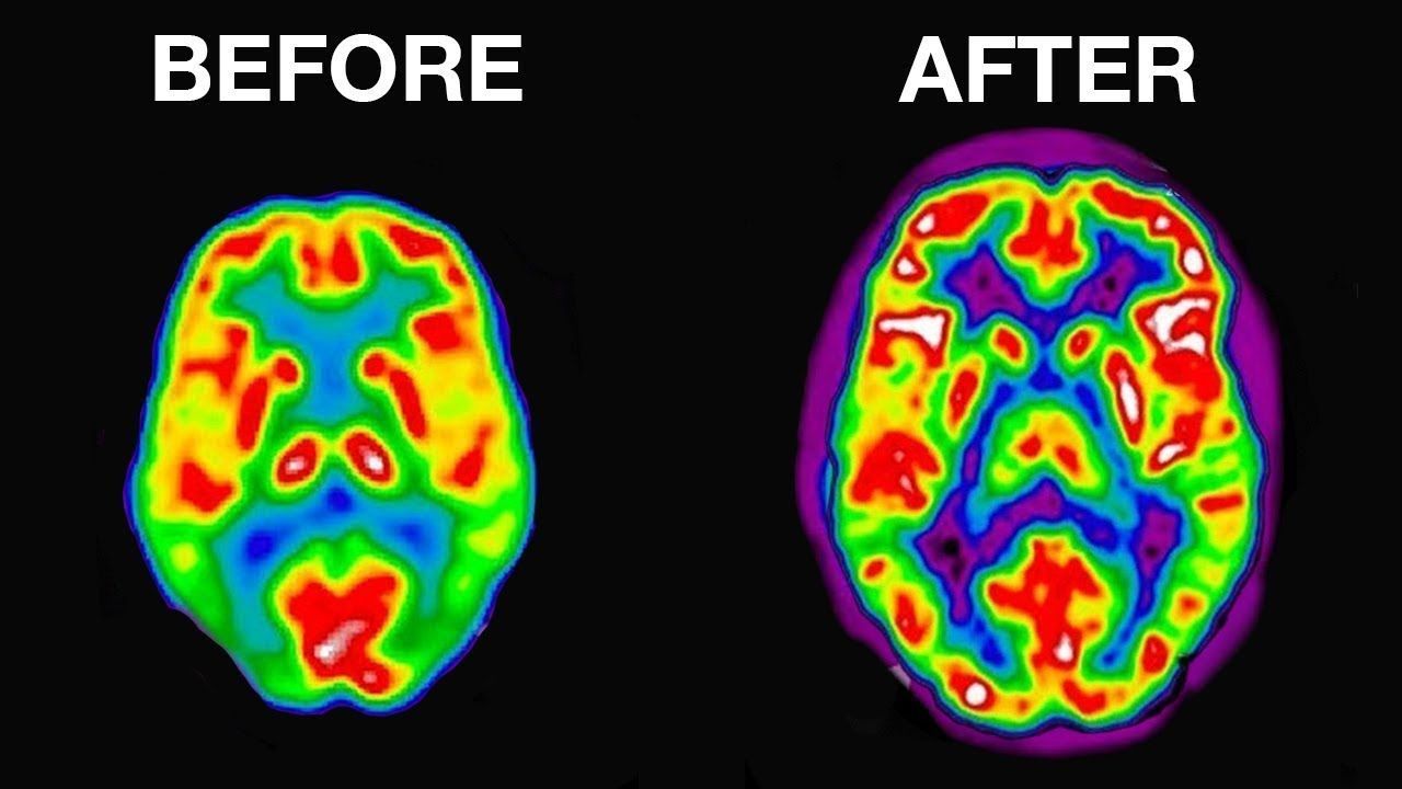 I compressed 40 years of meditation into 5 days... Here’s what happened
