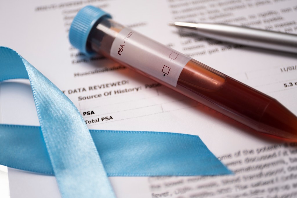 ‘I’m a prostate cancer specialist — don’t ignore these 7 warning signs’