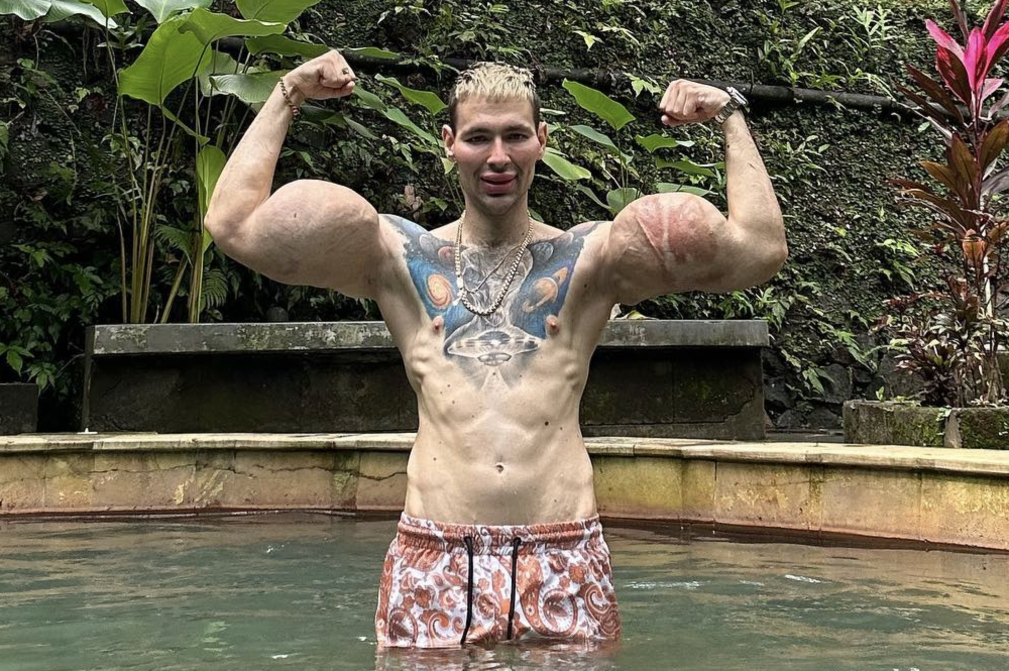 Russian ‘Popeye’ now: Deflated influencer denies reports of near-fatal ...