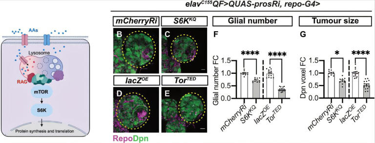How brain tumors respond to low-nutrient environments
