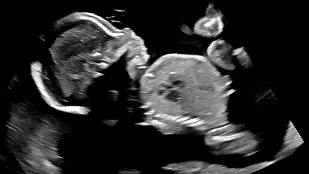 I’m starting a new chapter on the farm 🌾