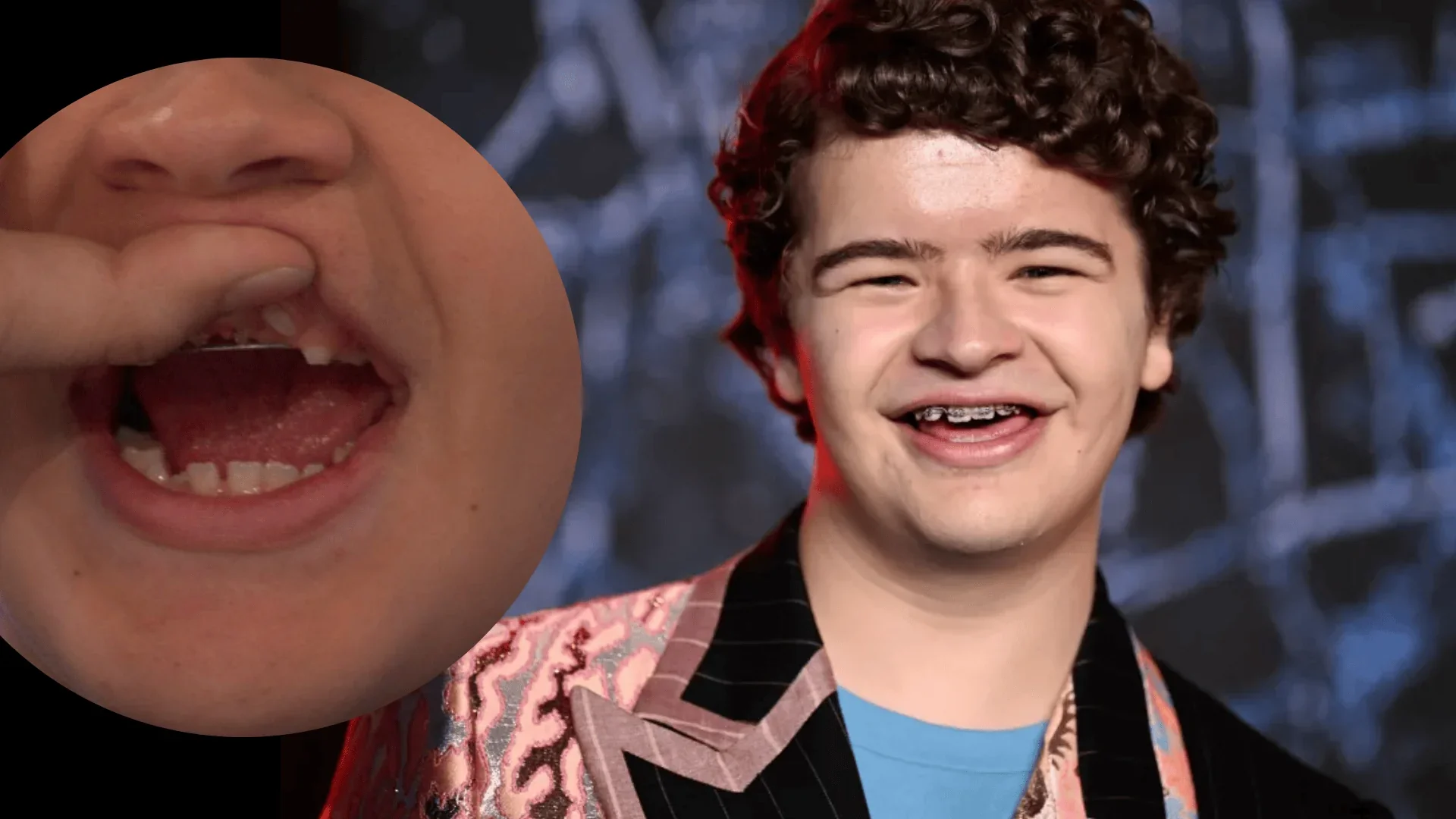 La rara condición de Gaten Matarazzo fue integrada al personaje de ...