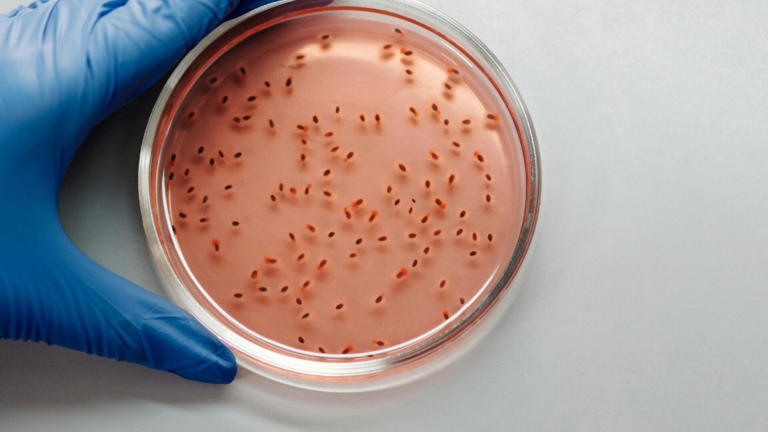 Poepbacteriën en E. coli: Wat moet je écht weten?