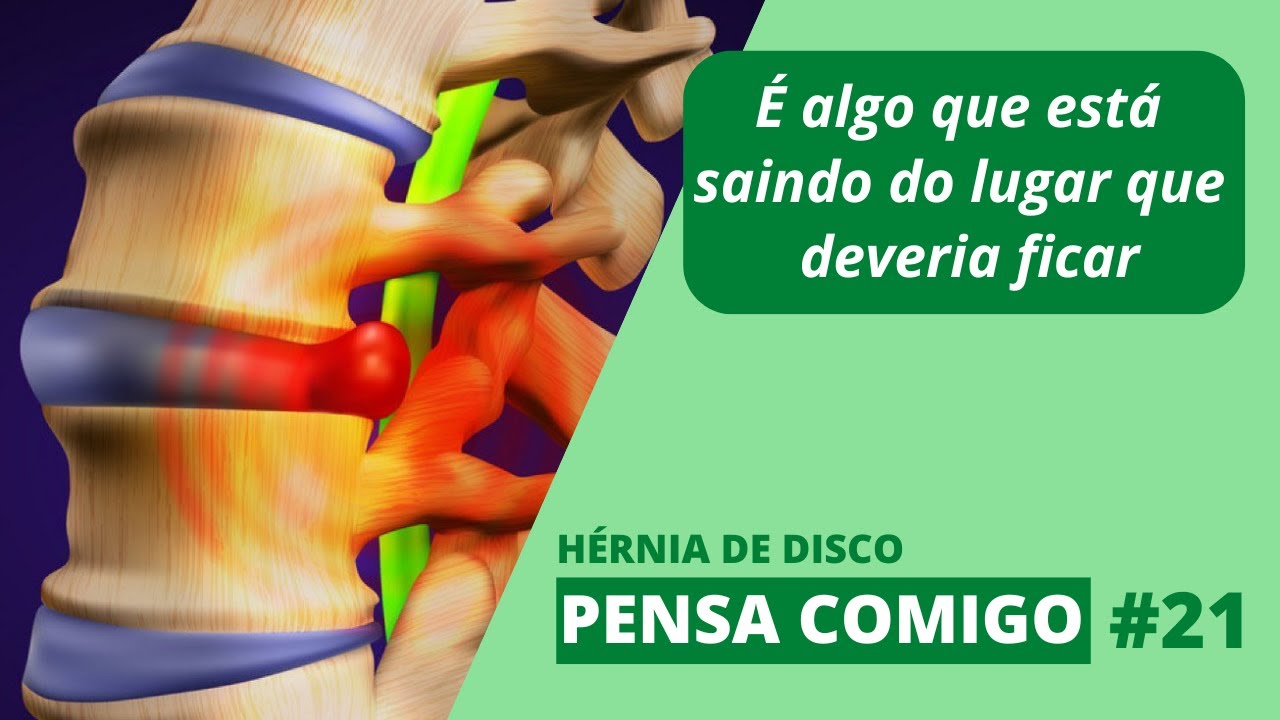 🤔 Pensa comigo #21 - 60% da hérnia de disco o corpo reabsorve. E os outros 40%?