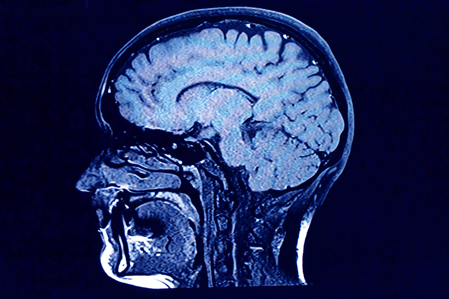 Human brains have 5 distinct 'epochs' in a lifetime, study finds