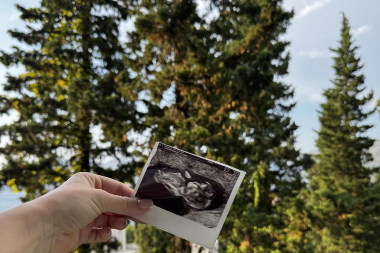 My baby boy died after three private scans failed to spot something was ...