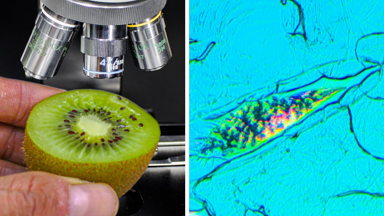 Kiwi fruit under microscope