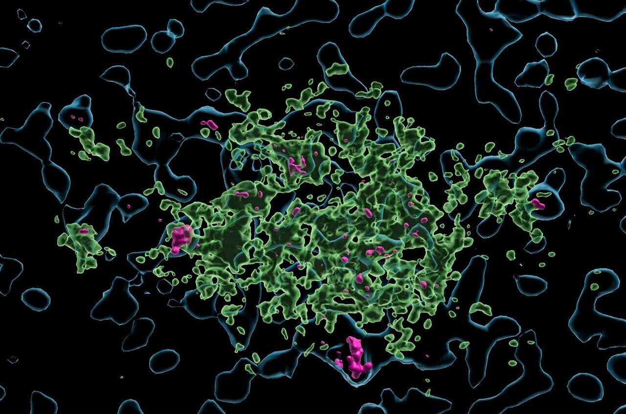How antibody therapy clears Alzheimer's plaques: Key immune mechanism ...
