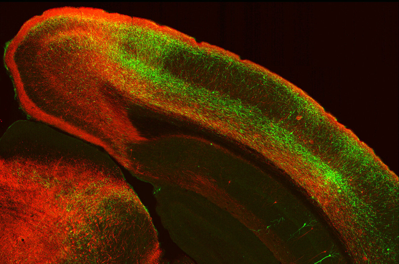Prefrontal cortex reaches back into the brain to shape how other ...