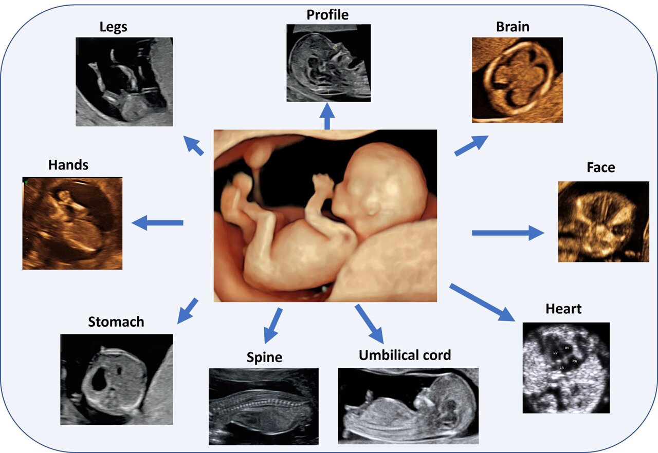 Routine first trimester ultrasounds lead to earlier detection of fetal ...