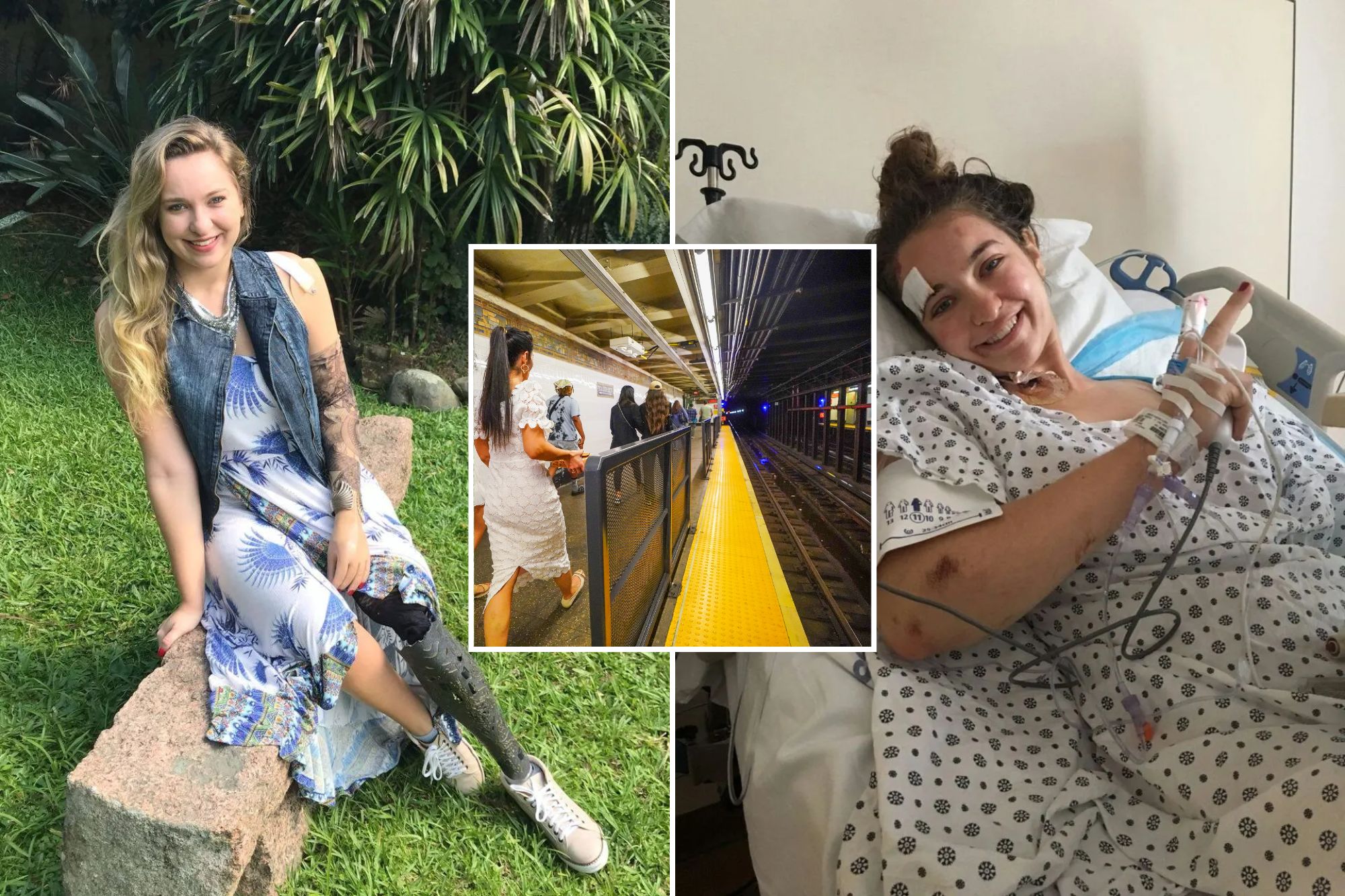 Student tourist who lost arm and leg in NYC subway accident wins ...