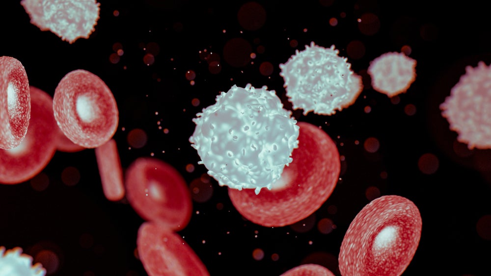 UK-developed leukaemia cell therapy to be offered on NHS