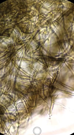 Moldy Food Under the Microscope — Safe to Cut Around?
