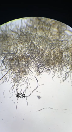 The Hidden World of Nematodes Under the Microscope