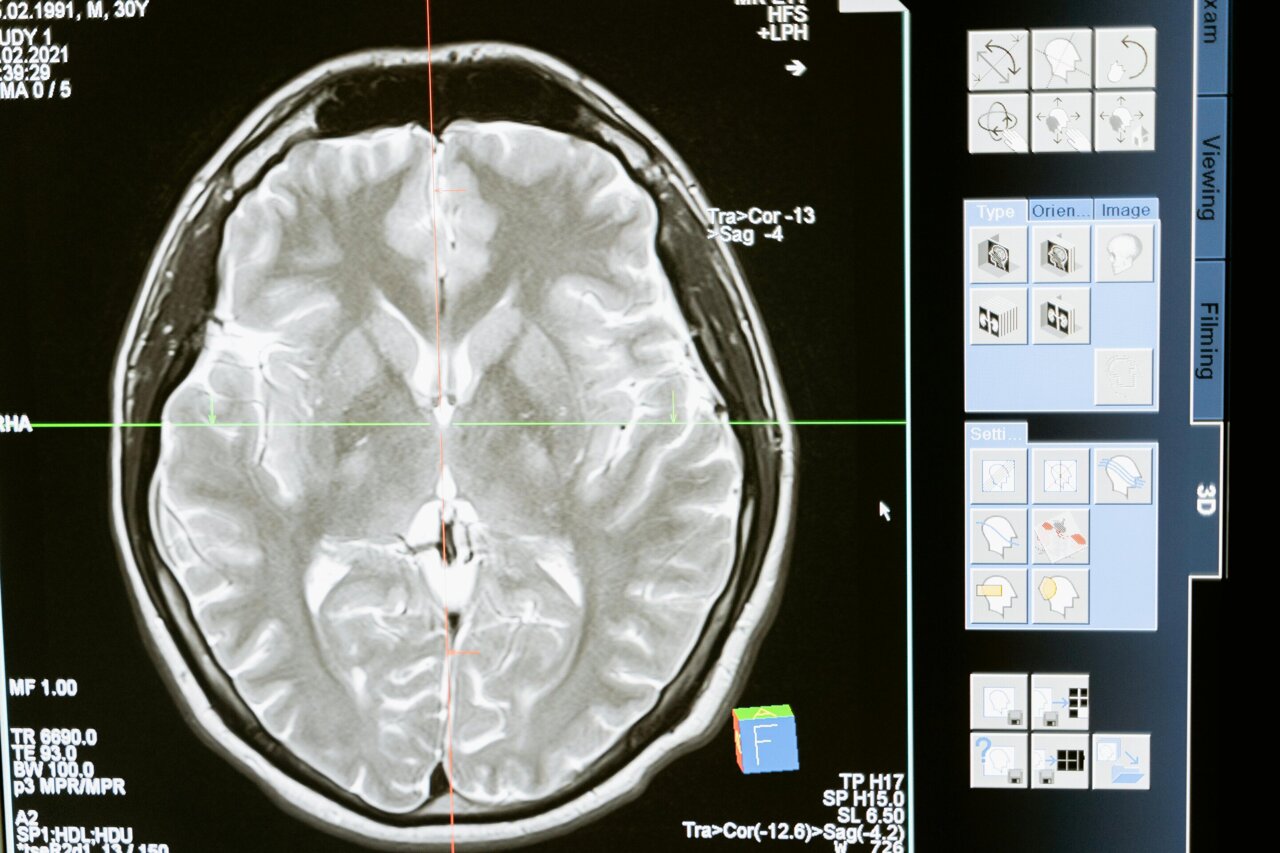 Noninvasive approach to treating stroke by boosting the brain's ...