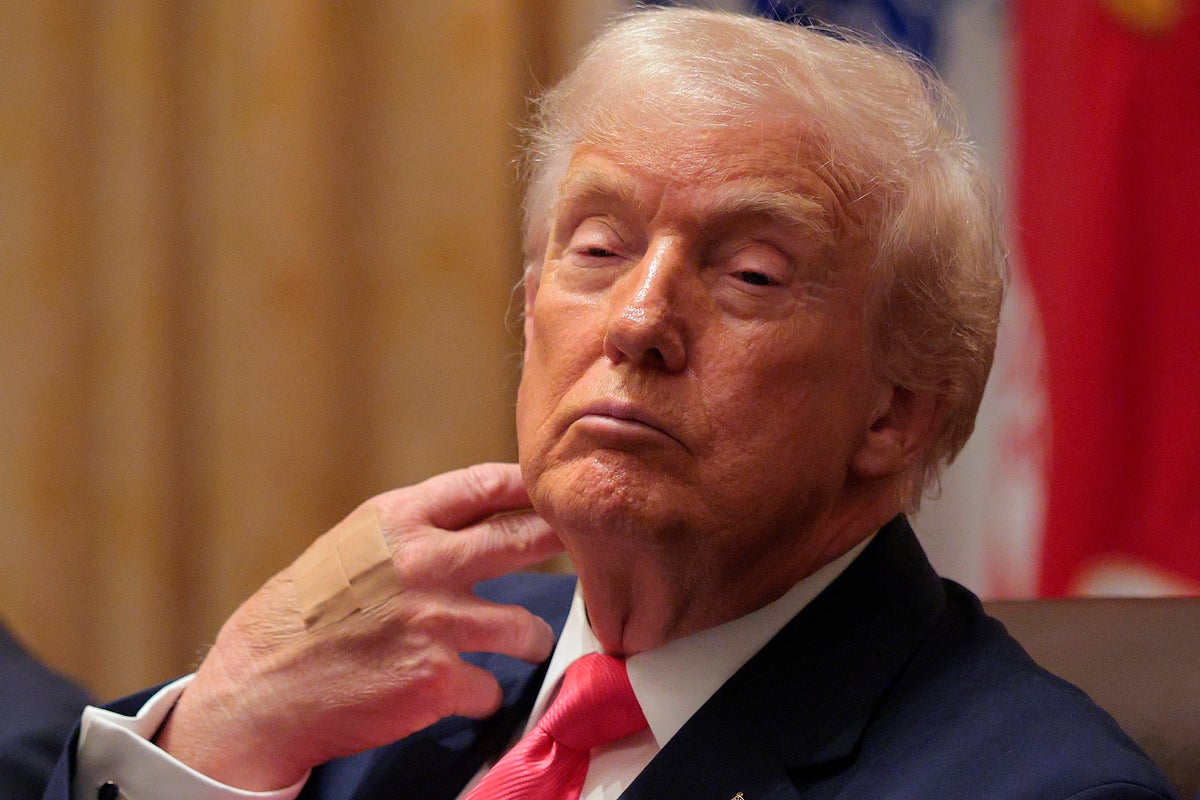 Trump complains about media interest in his health