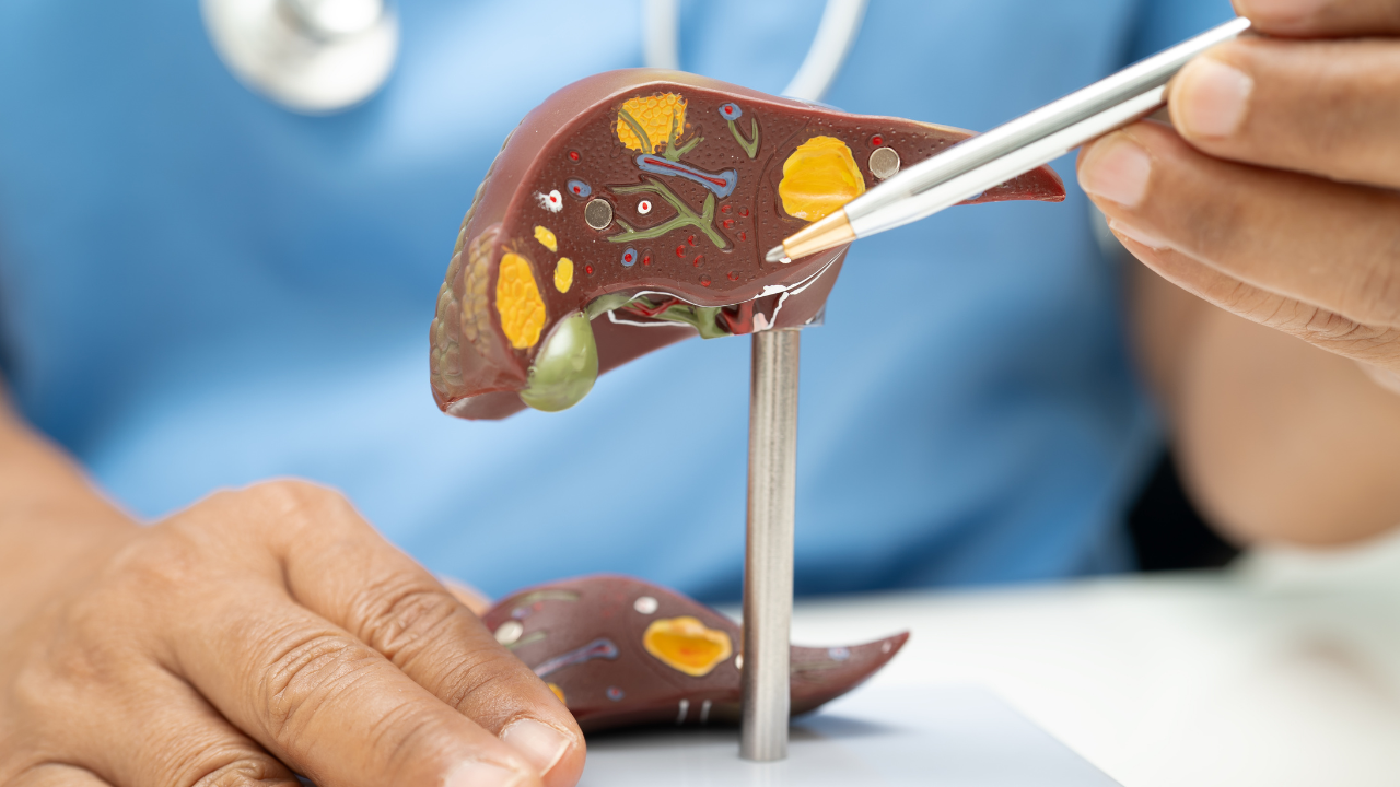 Liver-friendly diet: 10 foods that boost liver health, reduce fat and ...