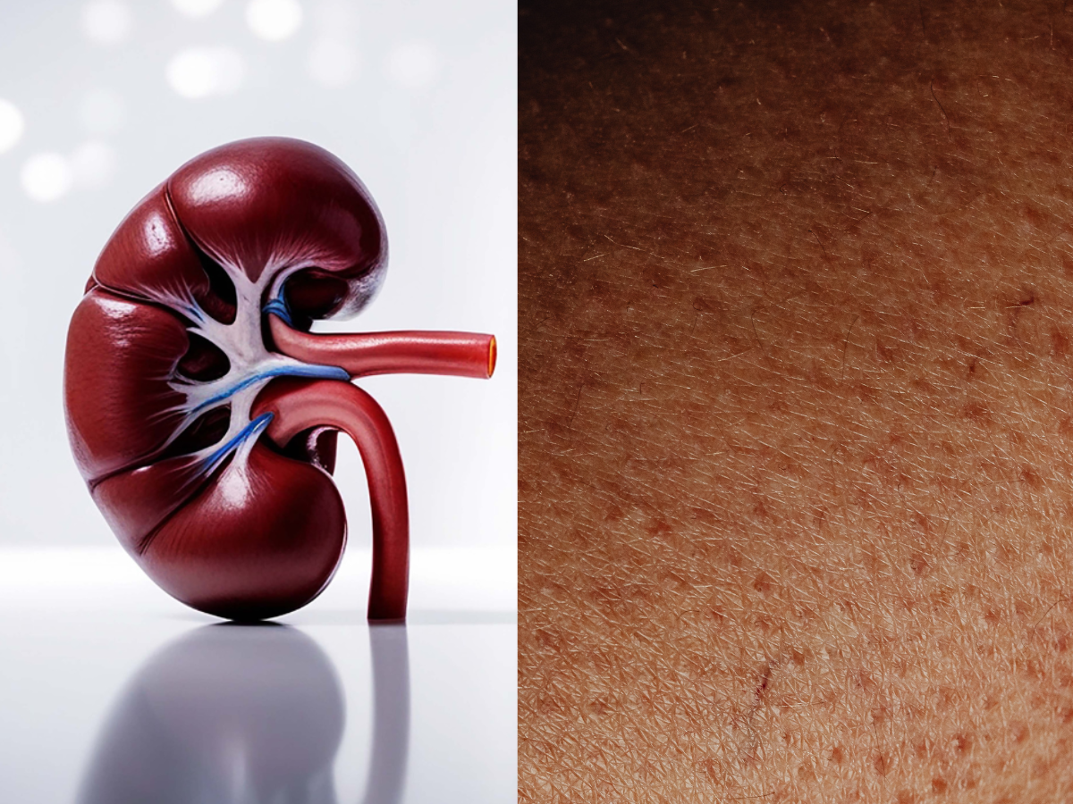 5 kidney damage signs visible on your skin: Could your dry, itchy skin ...