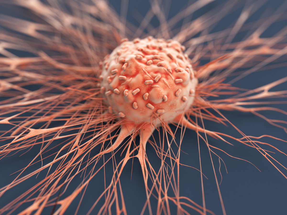 Oncologist reveals 4 cancer symptoms most people overlook