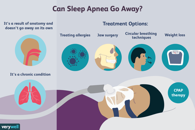 Does sleep apnea go away?