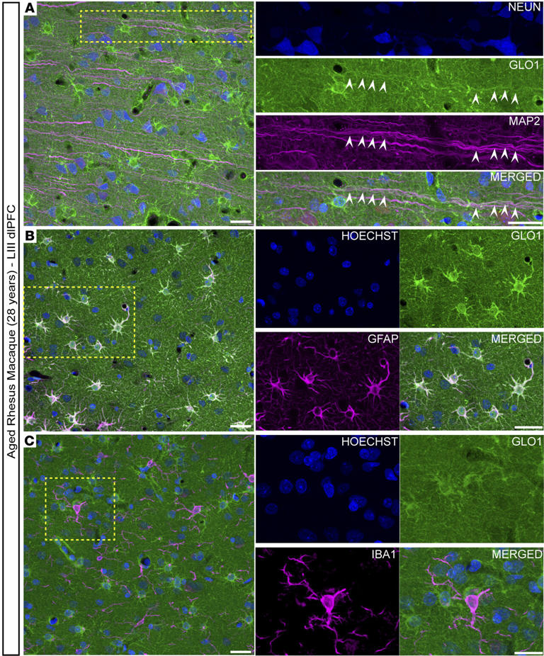 How the brain protects itself from Alzheimer's disease