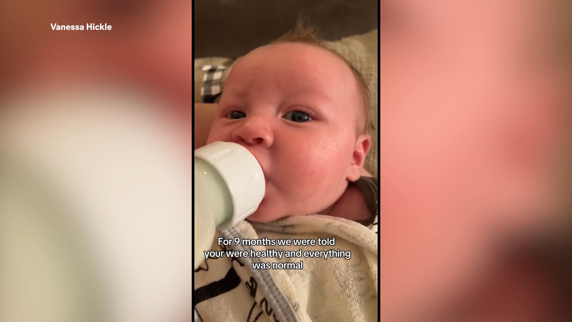 Mom shares baby’s journey to Joubert syndrome diagnosis