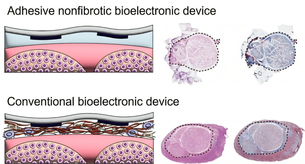 New bioadhesive strategy can prevent fibrous encapsulation around ...