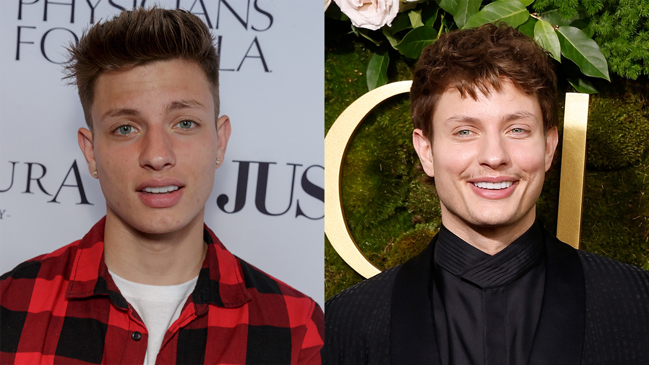 Matt Rife addressed his 'obviously fake' jawline & teeth well before ...