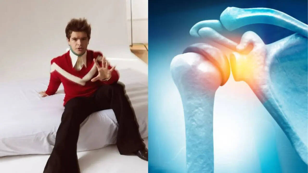 What is Cleidocranial Dysplasia, a Rare Genetic Bone and Teeth Disorder ...