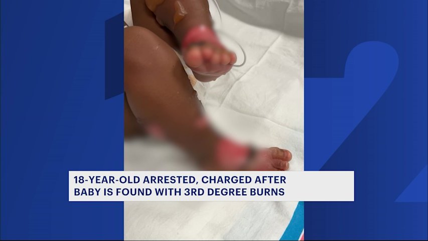 Woman arrested, charged after baby girl severely burned while under her ...
