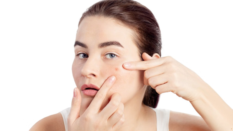 Causes of pimples: Does eating fried food cause pimples? Find out how ...
