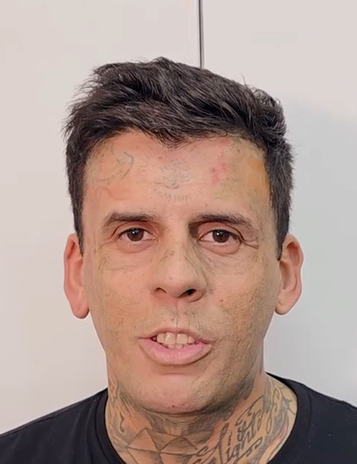 Man who had 95% of his body tattooed reveals stunning results of ...