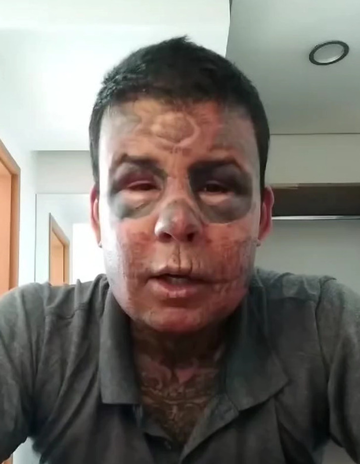 Man who had 95% of his body tattooed reveals stunning results of ...