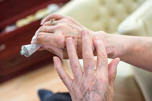 30 arthritis treatments that are actually making a difference for people