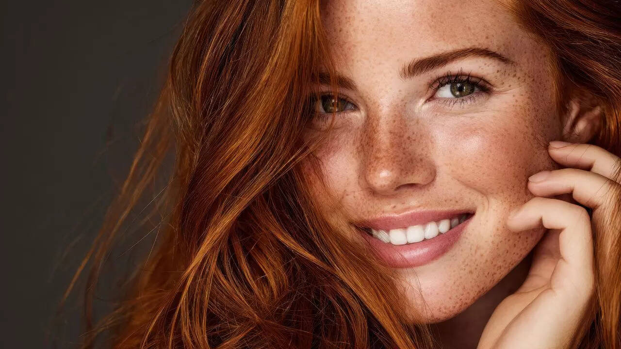 If you have red hair, this shocking new study says your wounds may heal ...