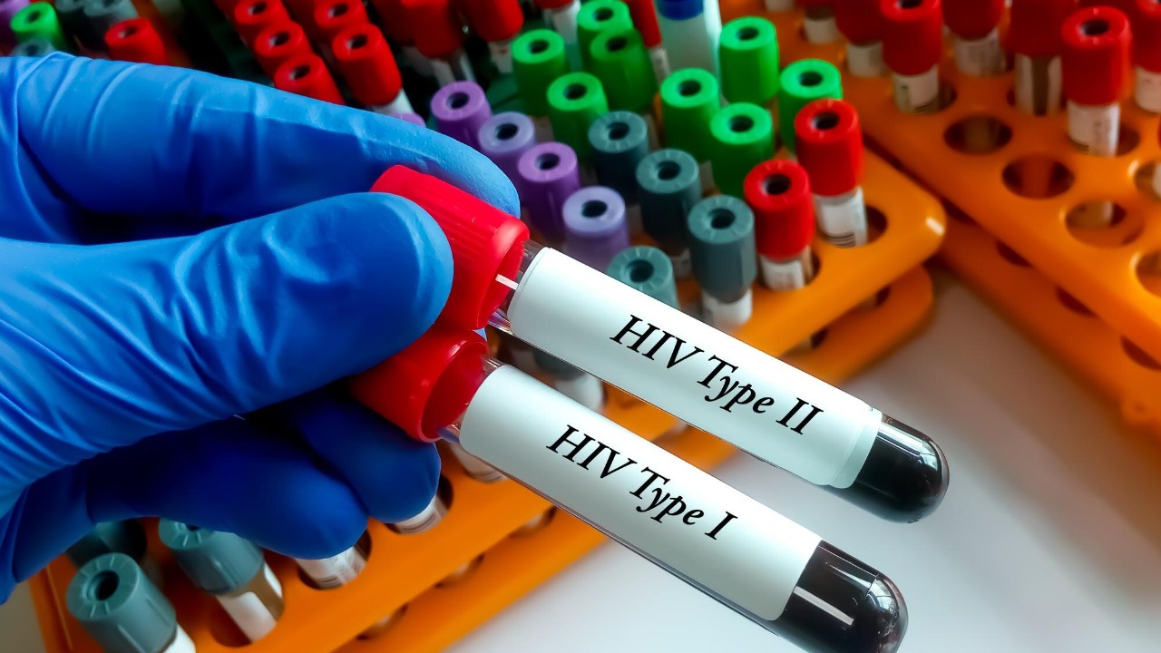 Early trials hint a ‘functional cure’ for HIV is near