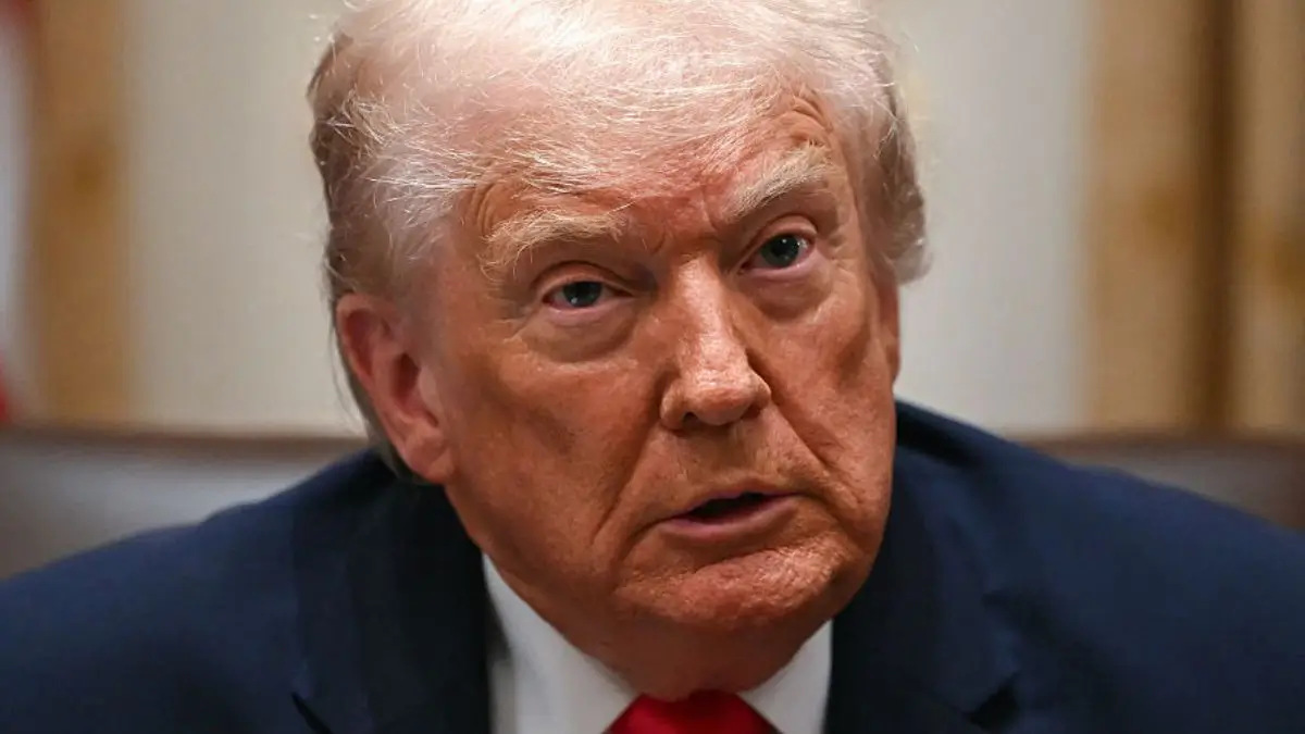 ‘That’s a lot of scalp’: Trump’s noticeable bald spot sets off health ...