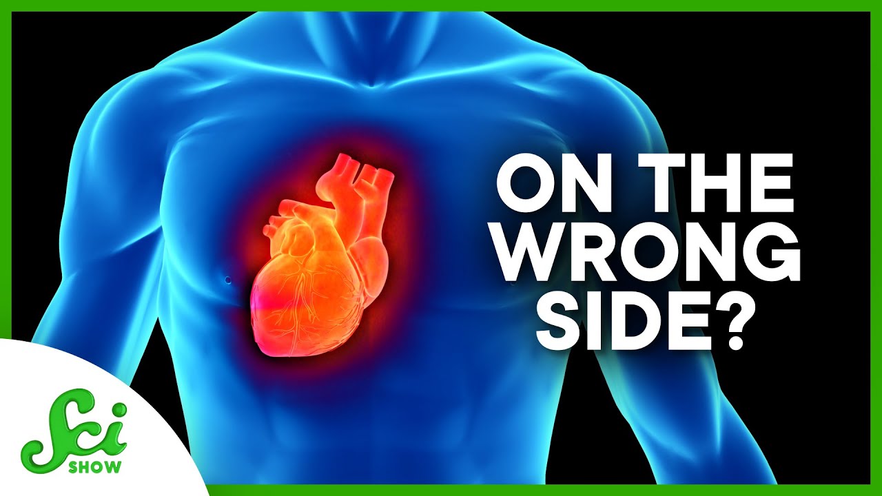 Is that a cold or are your organs flipped?