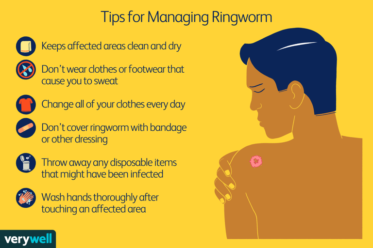 7 at-home treatments to clear ringworm quickly