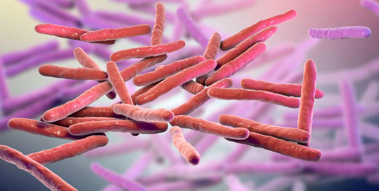 Did the CDC issue a Florida travel advisory due to rising leprosy cases?