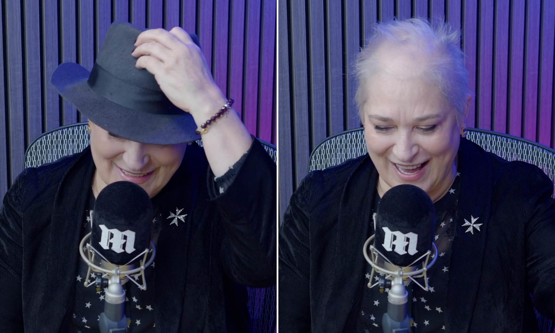 Sarah Vine reveals lifelong alopecia battle - showing her real hair for ...